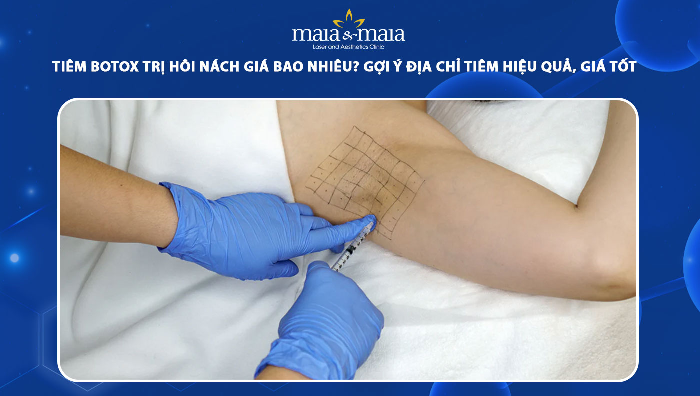 Tiêm botox trị hôi nách giá bao nhiêu? Địa chỉ tiêm giá tốt